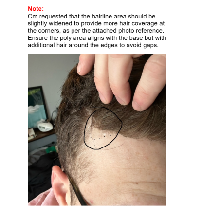 Custom Hair System