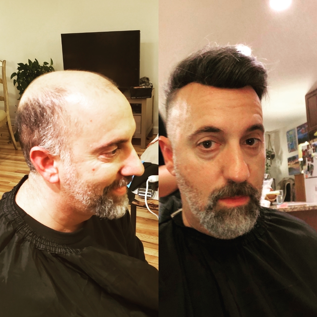 How to Get the Cheap Hair Replacement Systems? – Lavivid Hair