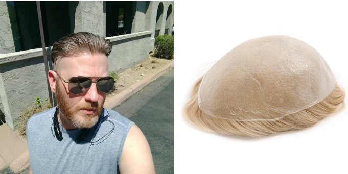 Different Hair Densities Lead to Different Looking of the Front Hairli ...