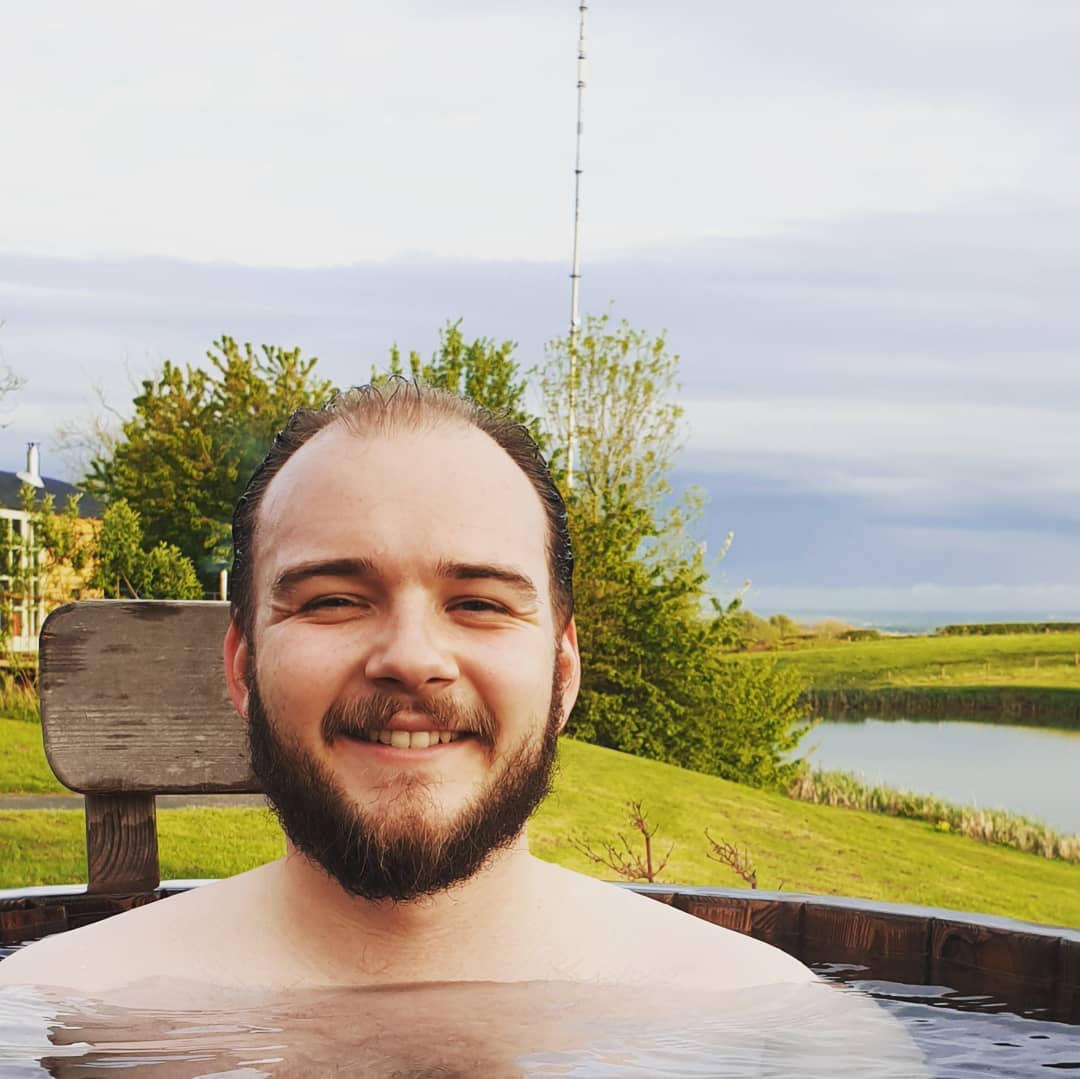 Male Baldness Cure and Treament – Lavivid Hair