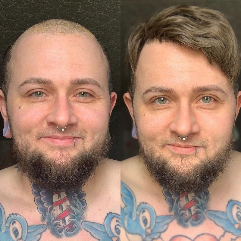 A Detailed Demonstration of LaVivid Ares Men's Hair System – Lavivid Hair