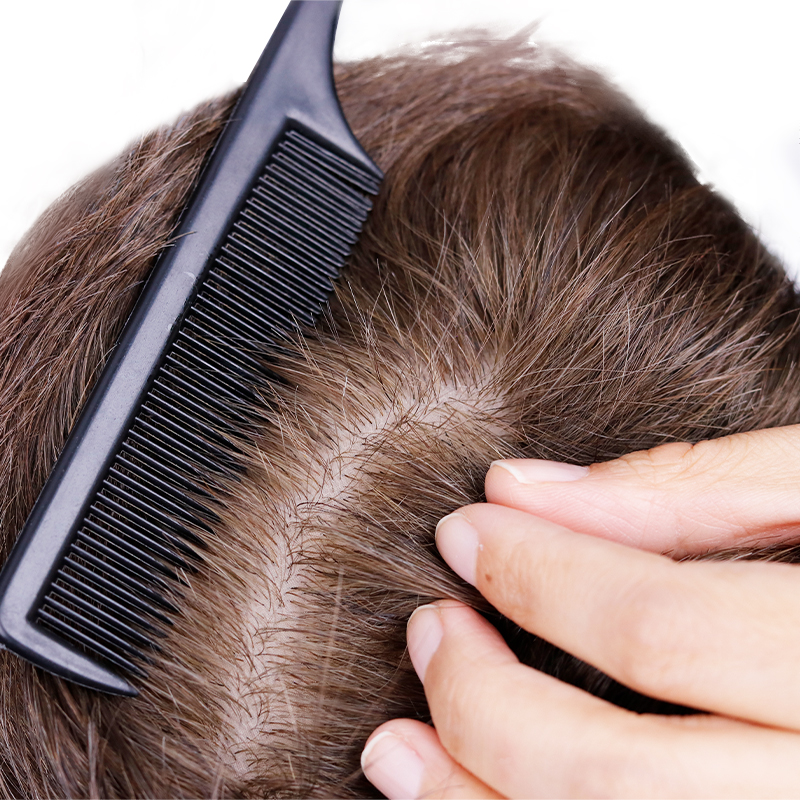 Rediscovering Confidence: The Core Values of Tyler Hair System ...