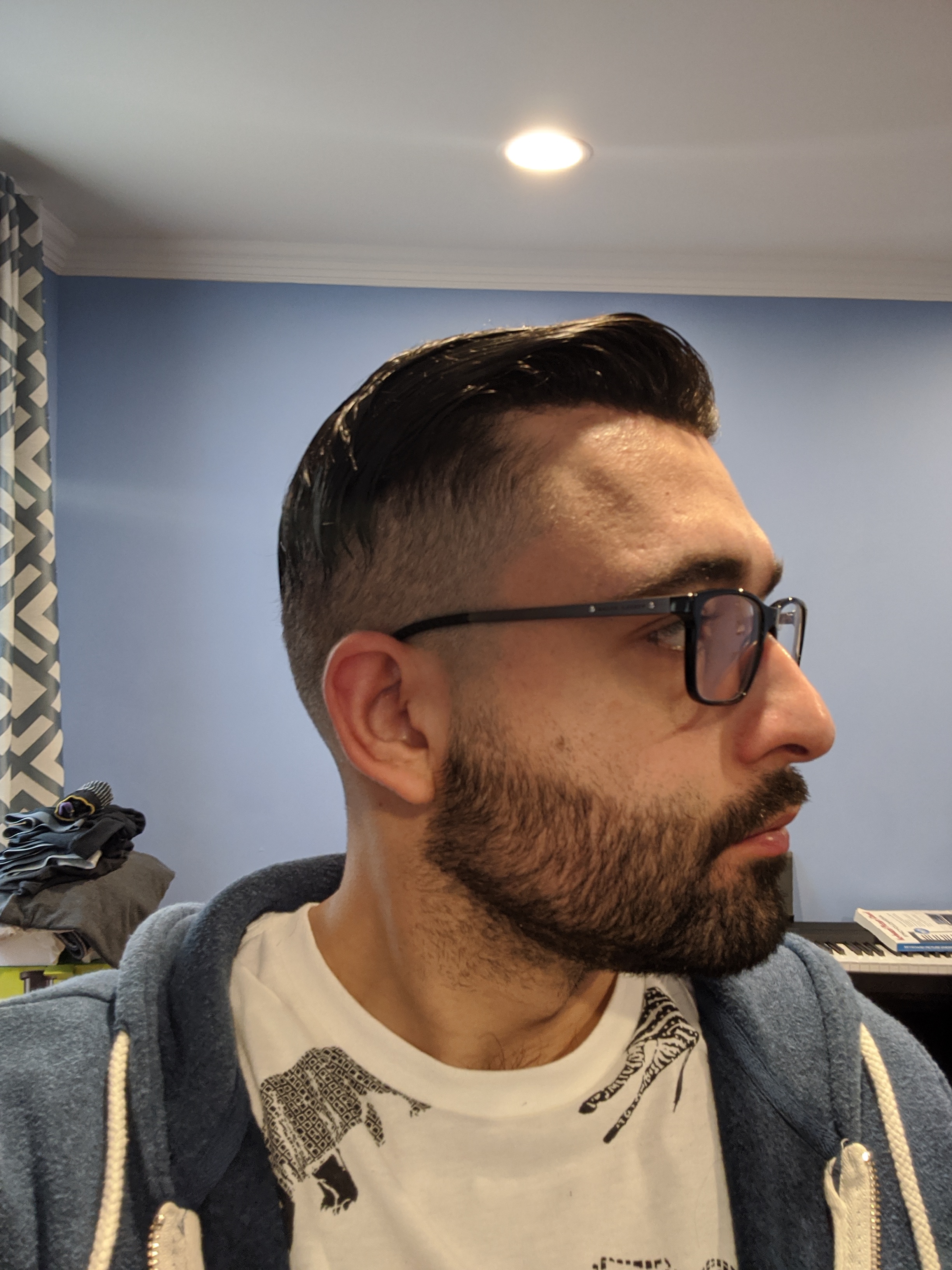 Do You Worry about the Receding Hairline? – Lavivid Hair