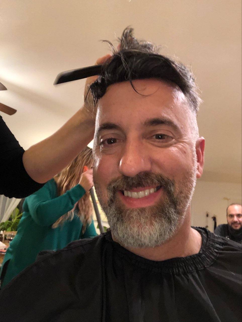 Have You Tried the Following Hair Loss Options for Men? – Lavivid Hair