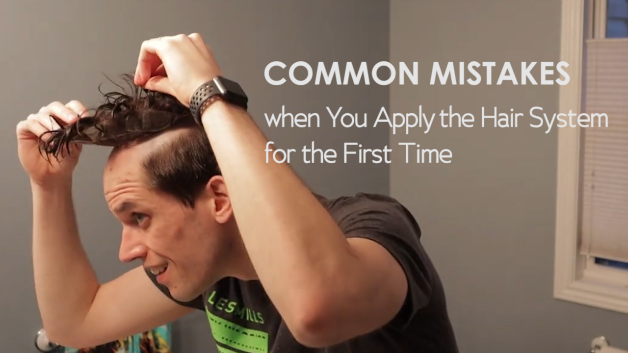 Why Many Bald People Choose Hair Replacement Options Rather Than Other ...