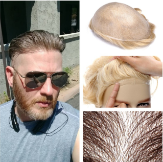 What's the Advantage of V-loop Technique for Skin Hair Systems ...