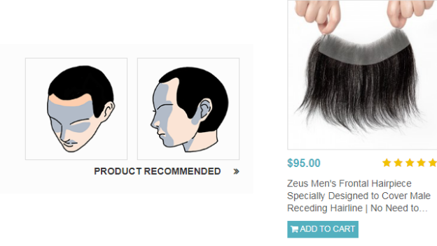 The Introduce of the Best Men Hair Loss Solution – Lavivid Hair