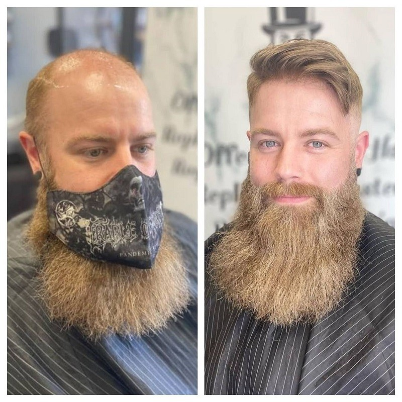 LaVivid’s Best Seller Hair Systems in 2011 – Lavivid Hair