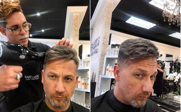 Hair Patch for Men: Transformations Before and After – Lavivid Hair