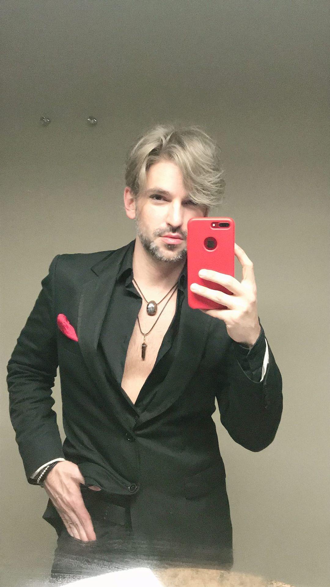 The Way to Address The Problem of Hair Loss in Young Men – Lavivid Hair