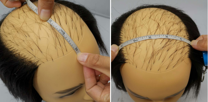 The Way to Measure Your Hair Loss Size and Choose A Matched Hair Syste ...