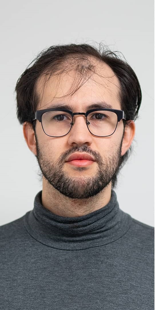 The Reasons for Leading The Man Go Balding – Lavivid Hair