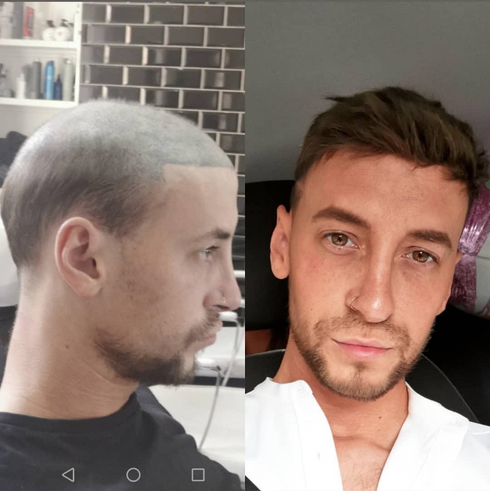 A Must Guide for Human Hair Pieces for Men – Lavivid Hair