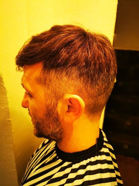 An Overall Guidelines of Hair Loss Treatment – Lavivid Hair