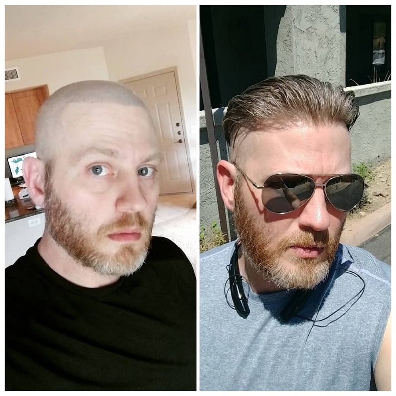 How to Make a Choice between A Hairpiece or Toupee? – Lavivid Hair