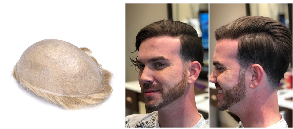 The Knowledge of Thin Skin Hair Systems – Lavivid Hair