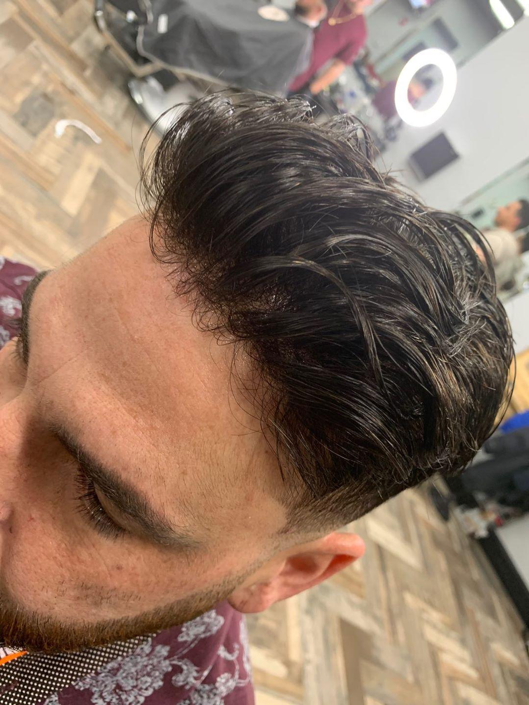 Does Vitamin D Have An Effect on Stopping Hair Loss? – Lavivid Hair