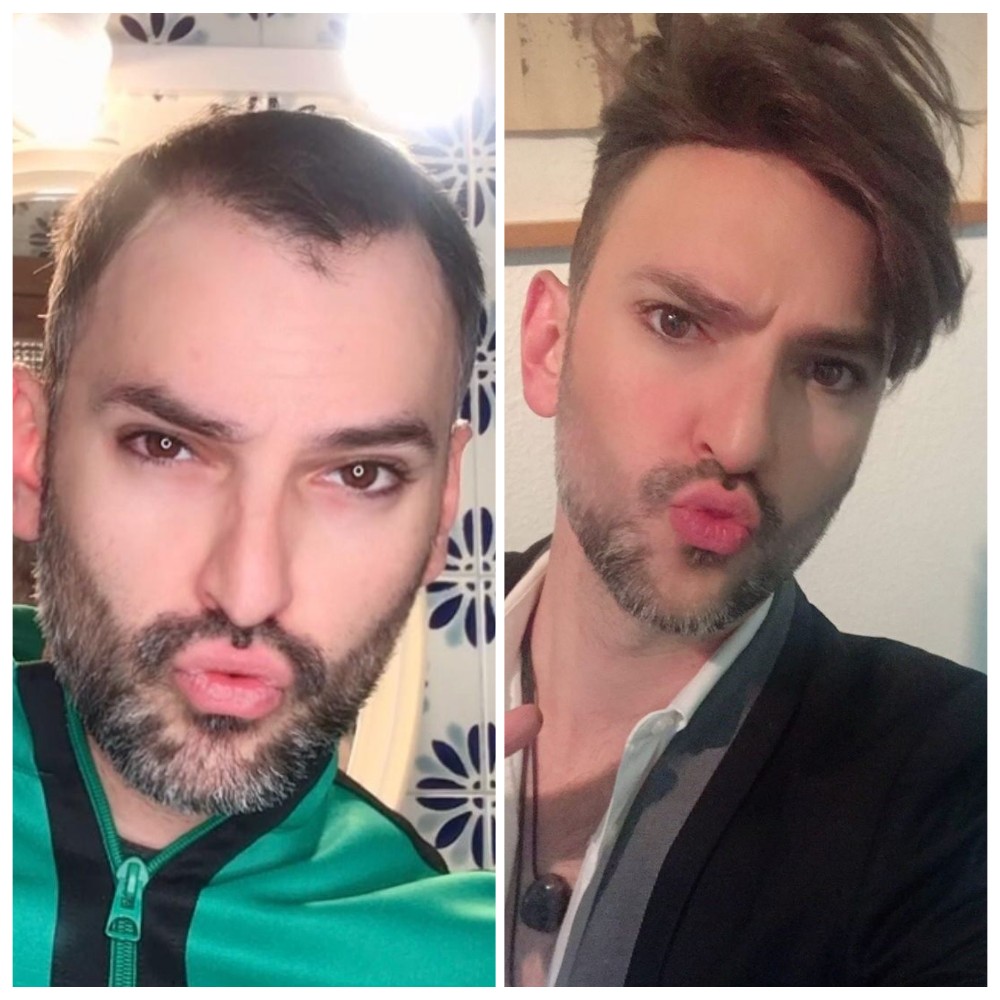 What Do We Learn from A Hair Loss Treatment Clinic near Me? – Lavivid Hair